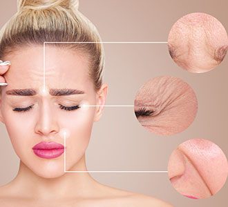 Botoks Nedir? Botoks Nasıl Yapılır? - Dr. Yasemin Savaş